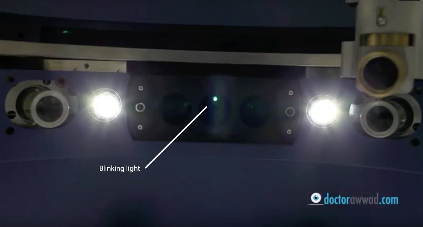 LASIK (femtoLASIK/IntraLASIK) | Dr Shady Awwad, eye surgeon at AUBMC